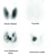 St. George - Sutherland Nuclear Medicine